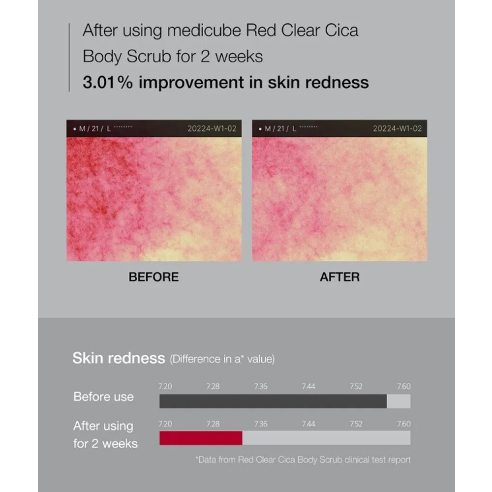 MEDICUBE Red Clear Cica Body Scrub 200g | DODO SKIN – DODOSKIN