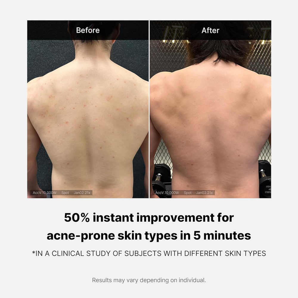 MEDICUBE Red Body Wash 400g | DODO SKIN – DODOSKIN